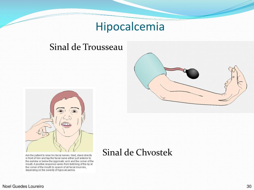 PPT - Noel Guedes Loureiro Médico Especialista em Medicina Intensivista ...