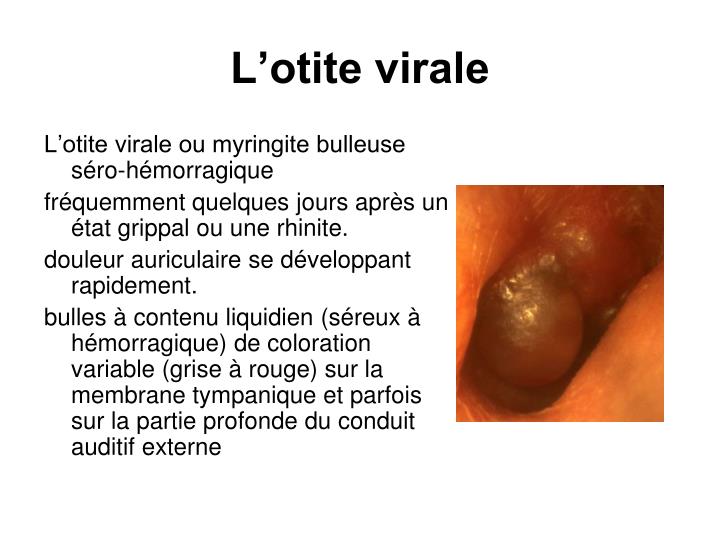 PPT - Infections ORL et bronchiques du jeune enfant PowerPoint ...
