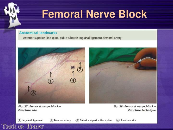 PPT - Lower Extremity Peripheral Nerve Block R4 장 지 혜 PowerPoint ...