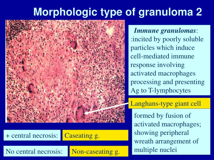 PPT - First Foundations in Pathology, Part 2: Acute and Chronic ...