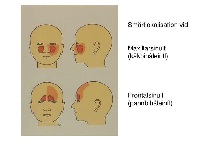 PPT - Rinosinuit PowerPoint Presentation - ID:915342