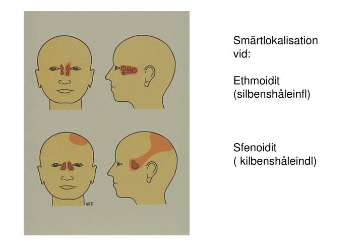 PPT - Rinosinuit PowerPoint Presentation - ID:915342