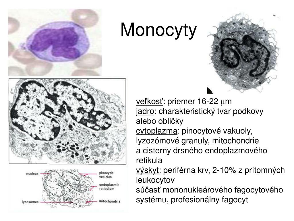 PPT - Imunochémia štúdium štruktúry protilátok a ich schopnosti viazať ...