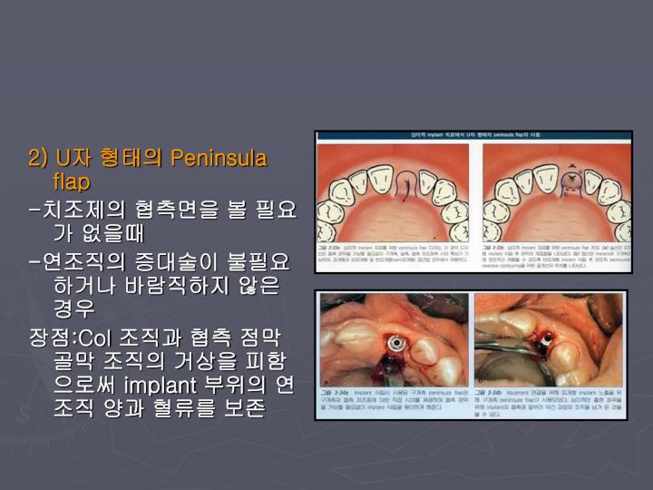 PPT - Anthony G. Sclar,DMD 보철과 손미향 PowerPoint Presentation - ID:918376