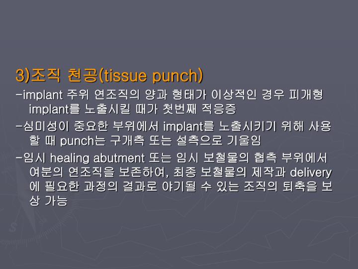 PPT - Anthony G. Sclar,DMD 보철과 손미향 PowerPoint Presentation - ID:918376