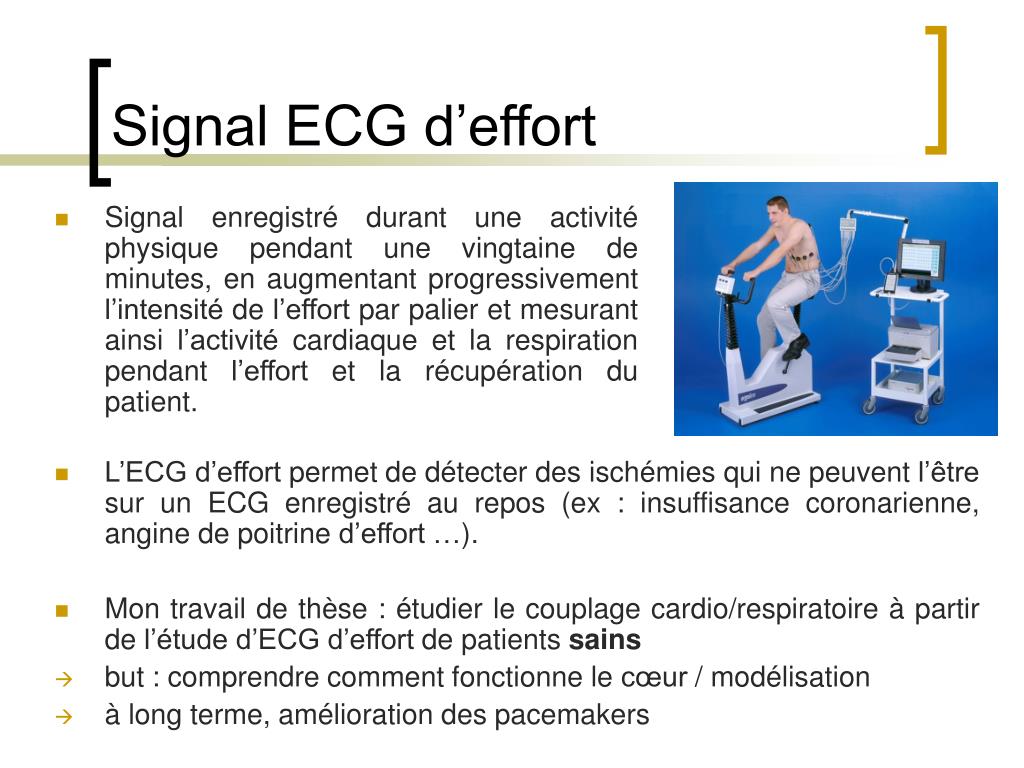 PPT - Analyse temporelle et fréquentielle des signaux biomédicaux ...