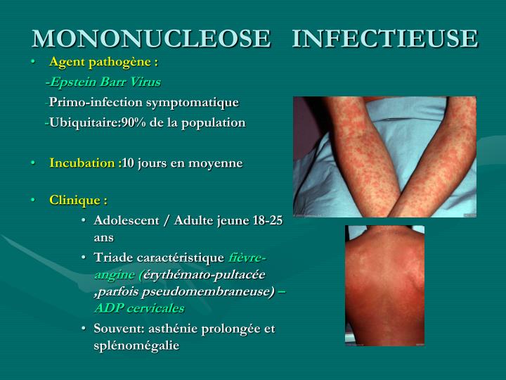 PPT - VIROSES A EXPRESSION CUTANÉE Dr L. TAIBI / DERMATOLOGIE CHU ...