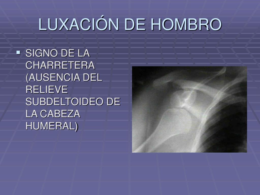 PPT - URGENCIAS EN TRAUMATOLOGIA PowerPoint Presentation, free download ...