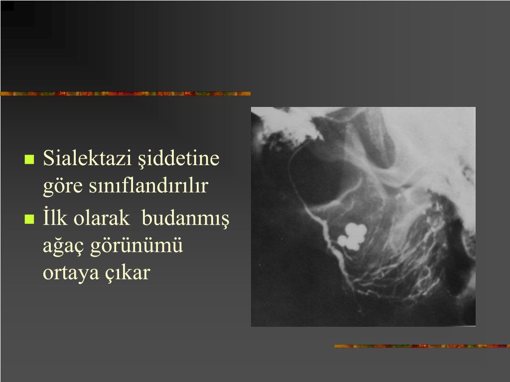 PPT - TÜKRÜK BEZLERİ, TİROİD VE PARATİROİD PATOLOJİLERİ PowerPoint ...