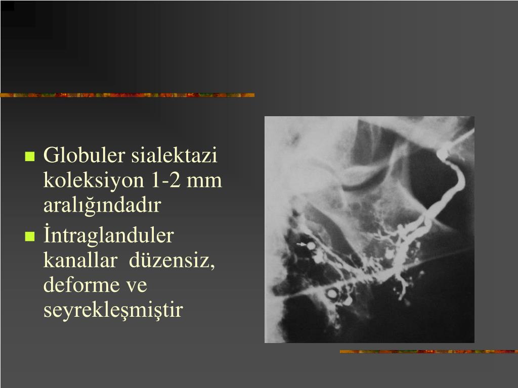 PPT - TÜKRÜK BEZLERİ, TİROİD VE PARATİROİD PATOLOJİLERİ PowerPoint ...