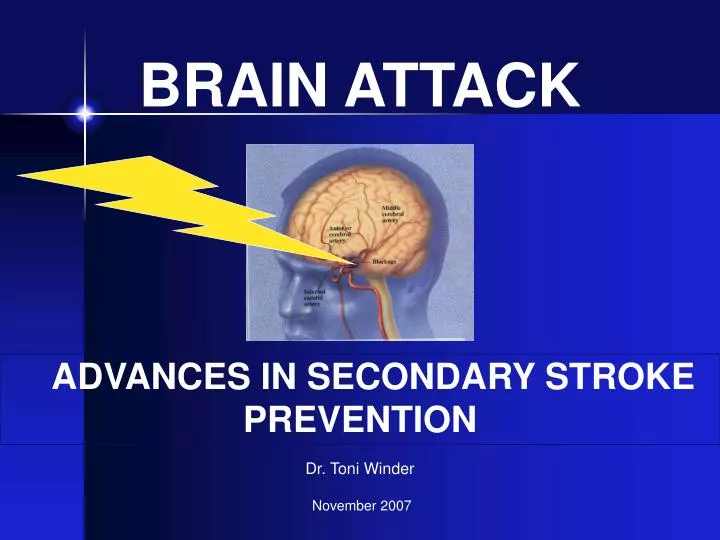 PPT - BRAIN ATTACK PowerPoint Presentation, free download - ID:923258