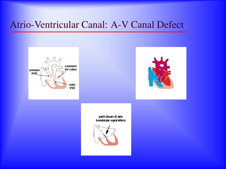 PPT - Sanjay Gandhi Postgraduate Institute of Medical Sciences ...