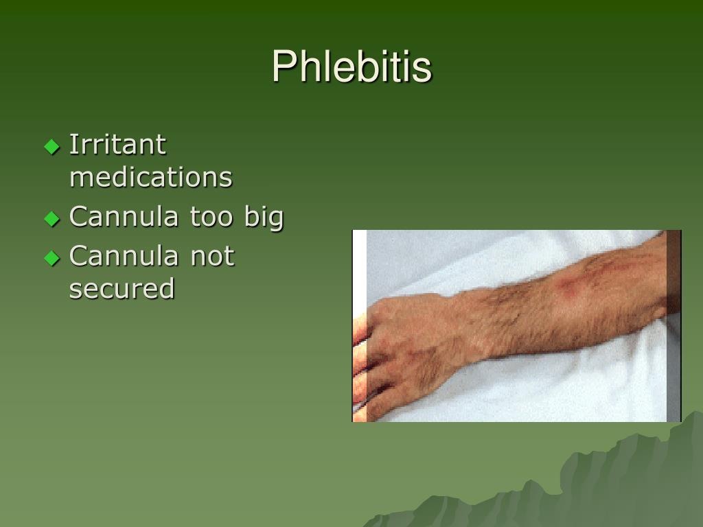 PPT - Complications of IV drug Therapy PowerPoint Presentation, free ...