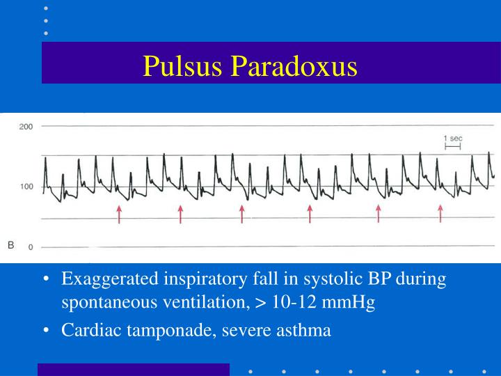 PPT - Hemodynamic Monitoring PowerPoint Presentation - ID:926236