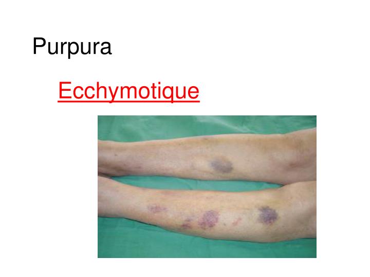 PPT - C A T devant PURPURA PowerPoint Presentation - ID:928896