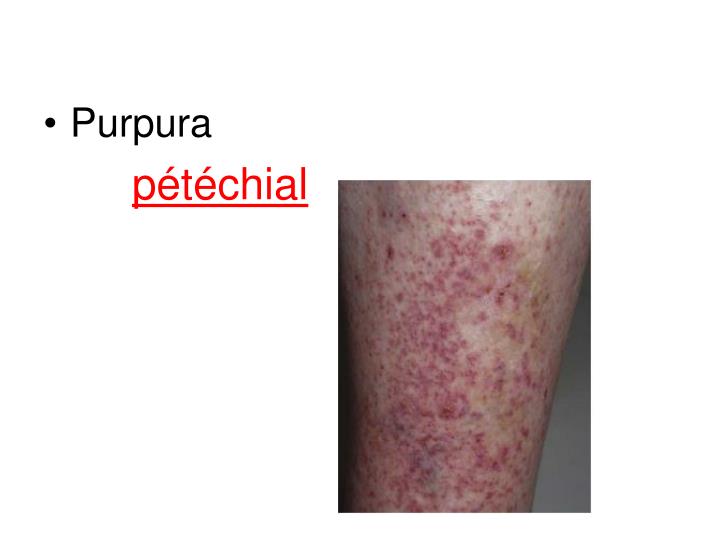 PPT - C A T devant PURPURA PowerPoint Presentation - ID:928896