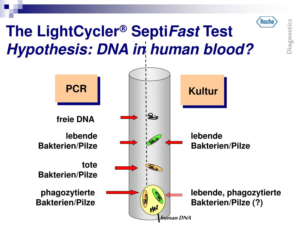 PPT - Neues aus der Sepsis-Diagnostik PowerPoint Presentation, free ...