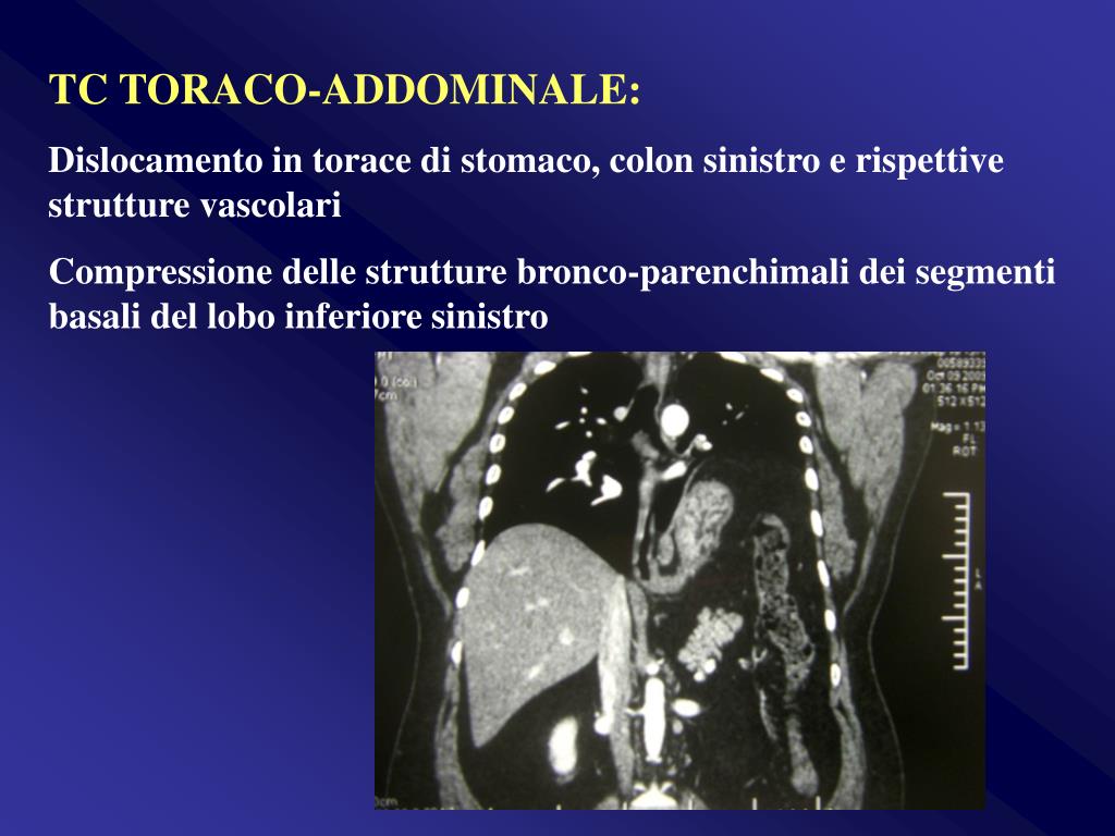 PPT - Dipartimento Area Chirurgica U.O.A di Chirurgia Direttore: L ...