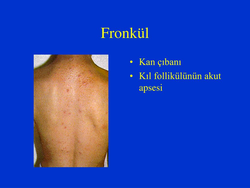 PPT - Stafilokokların Mikrobiyolojisi ve İnfeksiyon Oluşturma ...