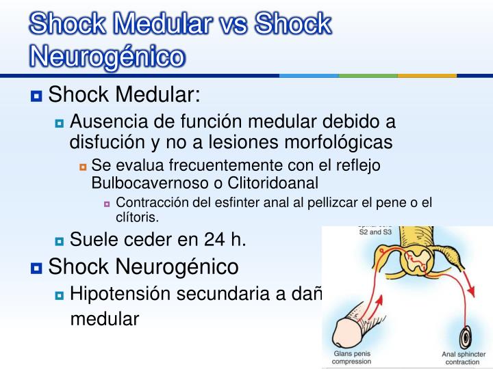 PPT - Trauma Raquimedular PowerPoint Presentation - ID:935186
