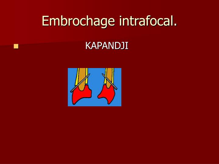 PPT - Fracture de l’extrémité inférieure du radius PowerPoint ...