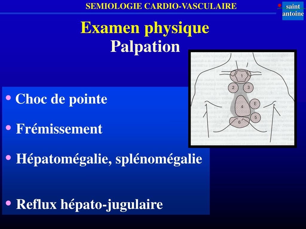 PPT - • Signes fonctionnels (SF) Douleur thoracique, dyspnée ...