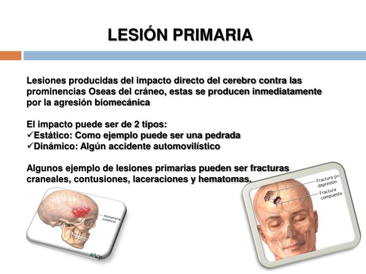 PPT - TRAUMATISMO Craneoencefálico (TCE) PowerPoint Presentation - ID ...
