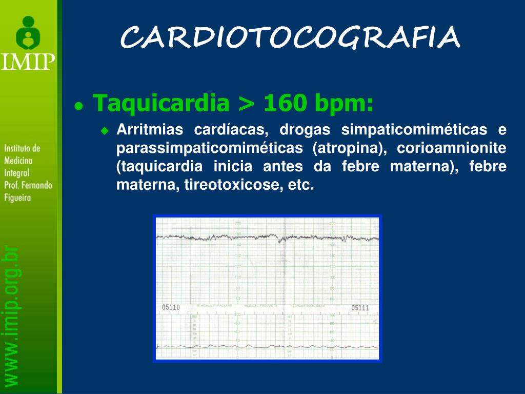 PPT - Fetal Vitality Assessment Methods and Criteria PowerPoint ...