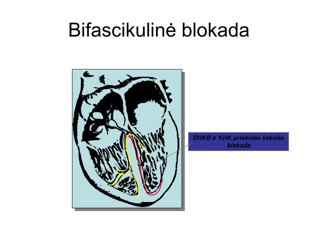 PPT - Elektrofiziologinio tyrimo reikšmė nustatant ir gydant ...