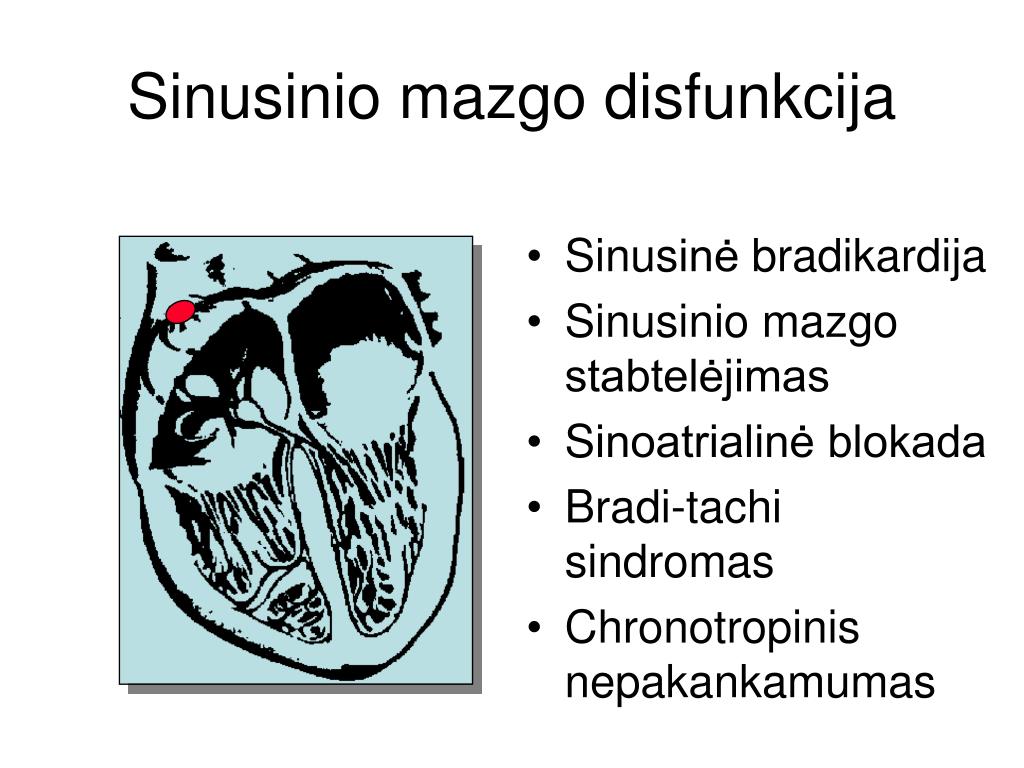 PPT - Elektrofiziologinio tyrimo reikšmė nustatant ir gydant ...
