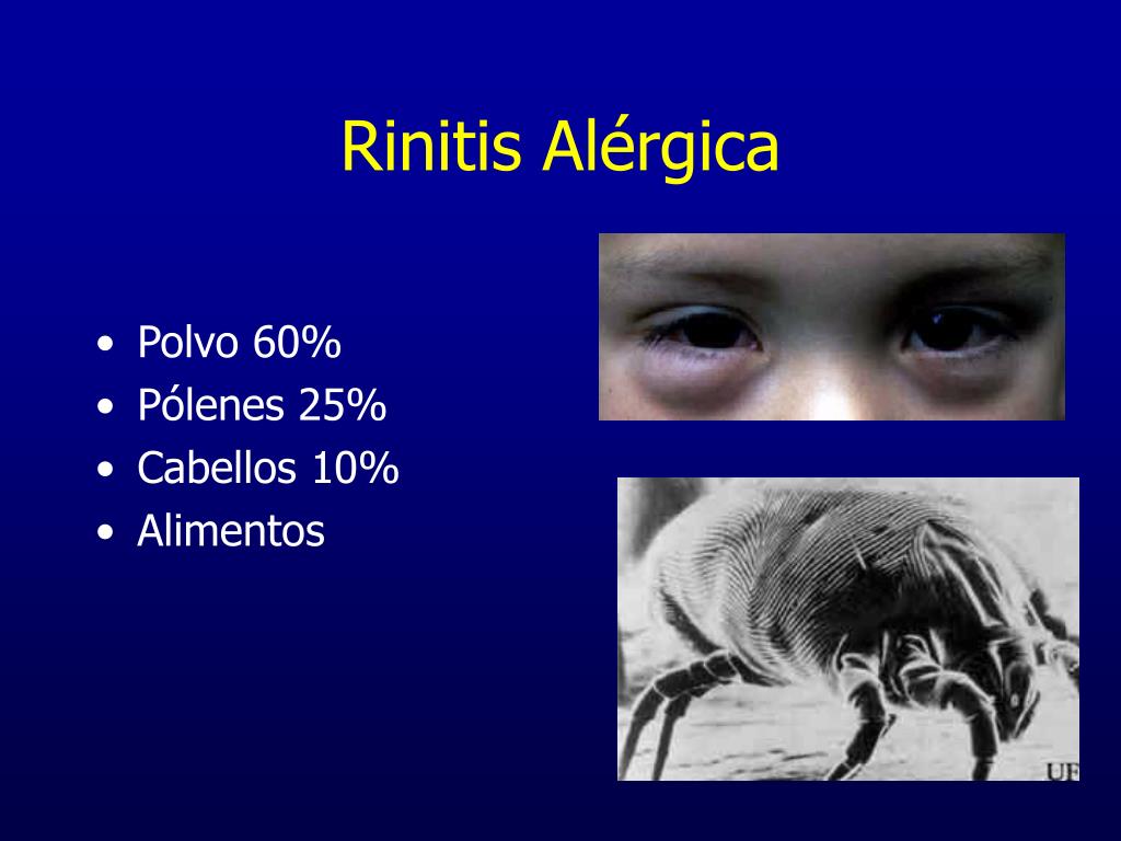 PPT - PATOLOGIA NASOSINUSAL Dra. Jaqueline Ramírez Anguiano médico ...