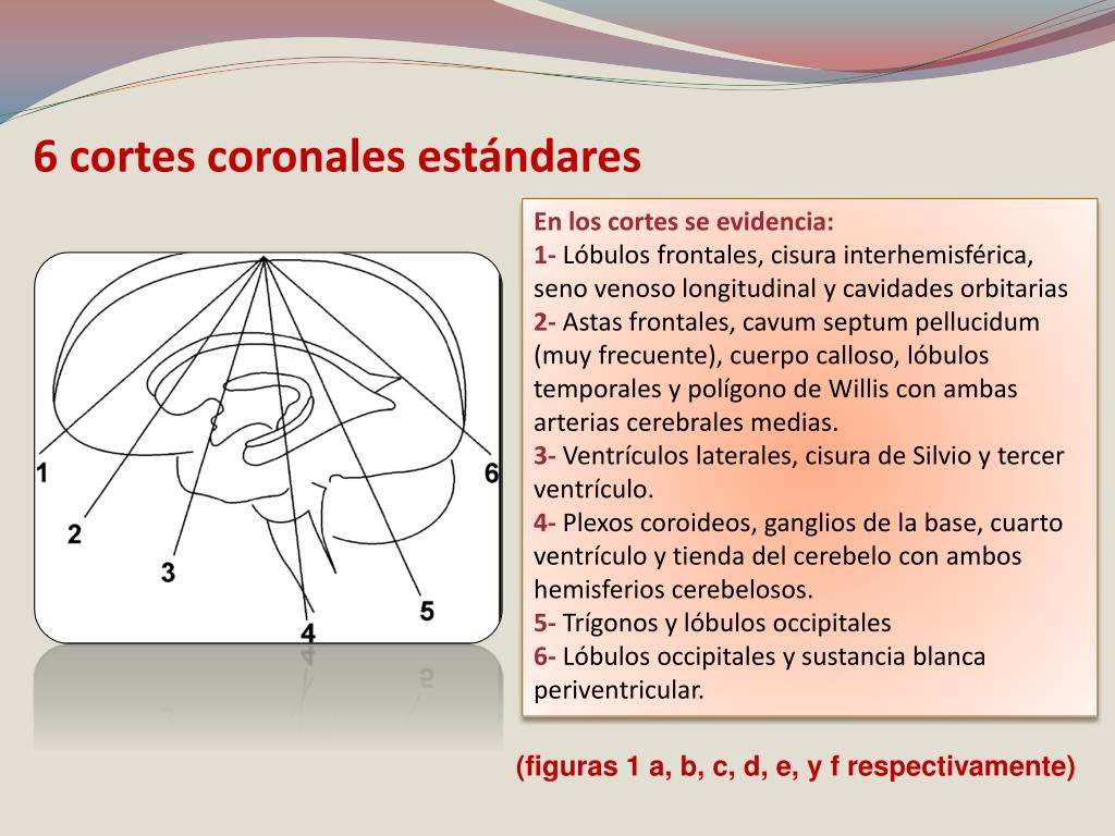 PPT - Complexo Hospitalario Universitario Vigo PowerPoint Presentation ...