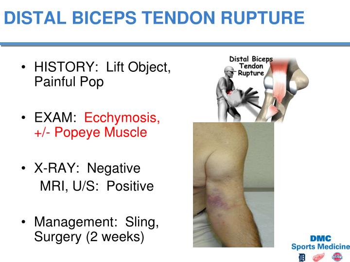 PPT - ACUTE MANAGEMENT OF TRAUMATIC SPORTS INJURIES PowerPoint ...