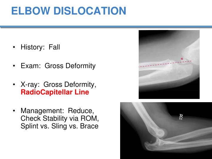 PPT - ACUTE MANAGEMENT OF TRAUMATIC SPORTS INJURIES PowerPoint ...