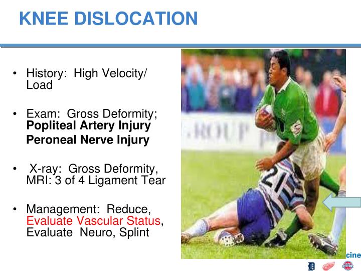 PPT - ACUTE MANAGEMENT OF TRAUMATIC SPORTS INJURIES PowerPoint ...