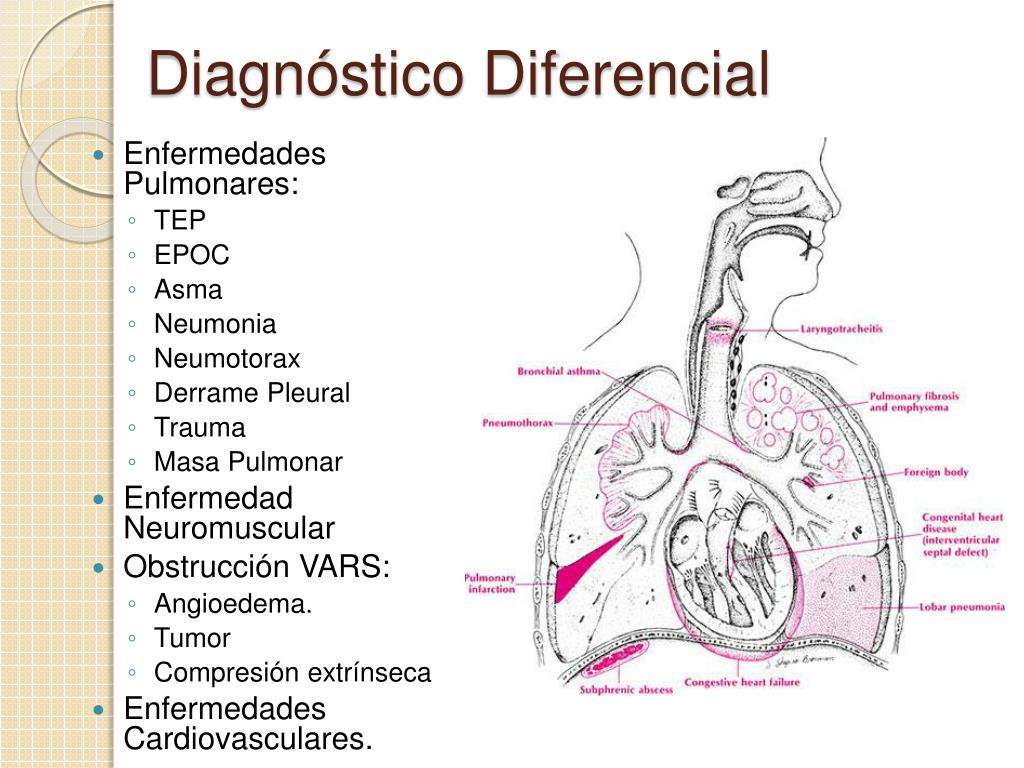 PPT - Evaluación de la Disnea en el Paciente Adulto Mayor PowerPoint ...