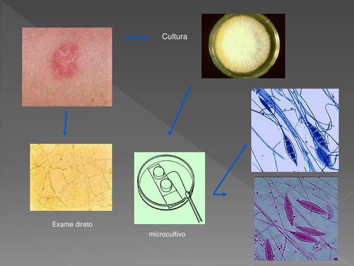 PPT - CLASSIFICAÇÃO DAS MICOSES PowerPoint Presentation - ID:960267