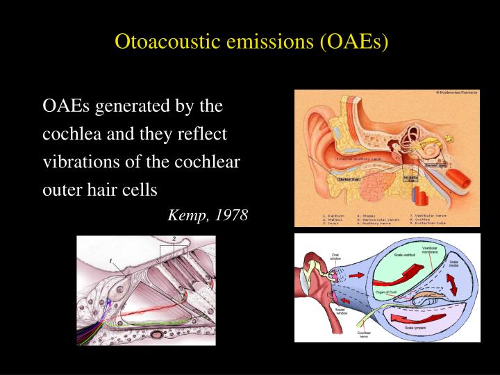 PPT - Borka Ceranic MD ENTspec PhD Department of Audiology and Neuro ...