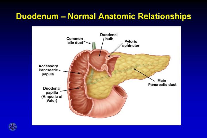 PPT - Varioliform Gastritis In Patient With Lymphocytic Gastritis ...