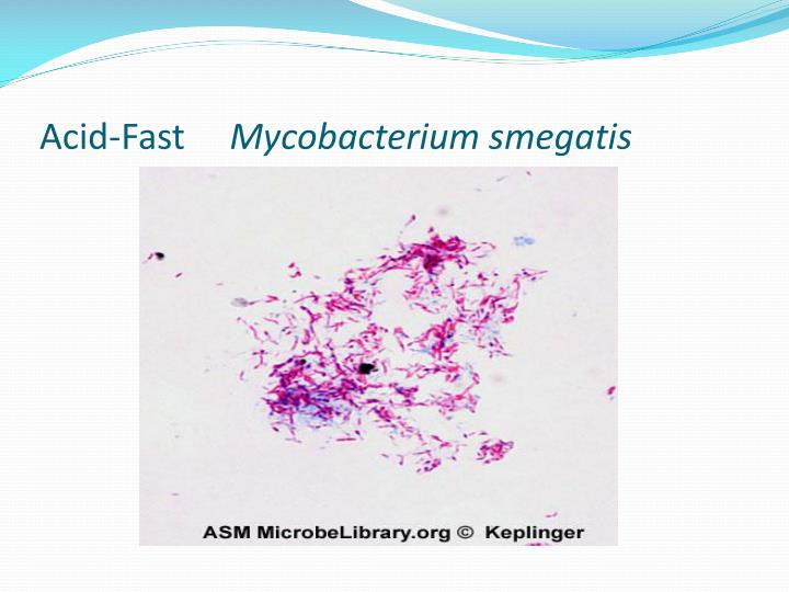 PPT - Ex. 9 Acid-Fast Stain PowerPoint Presentation - ID:967188