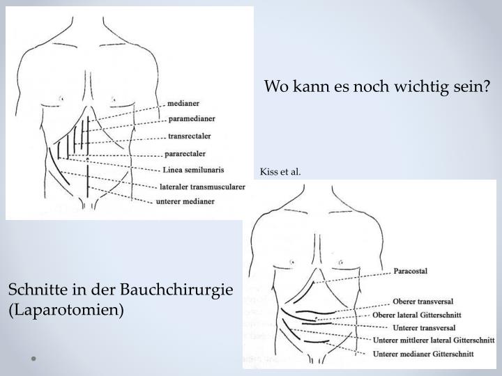 PPT - Struktur der Bauchwand - Muskeln und Faszien - PowerPoint ...