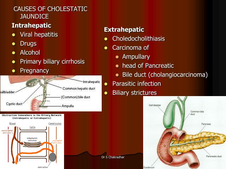 PPT - JAUNDICE Definition :- PowerPoint Presentation - ID:968121
