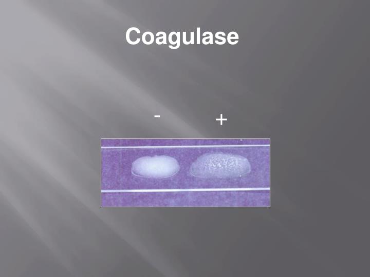 PPT - Identificação de microrganismos por testes bioquímicos PowerPoint ...