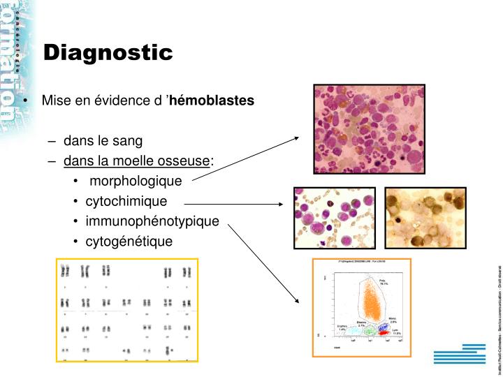 PPT - Les leucémies aiguës PowerPoint Presentation - ID:970499