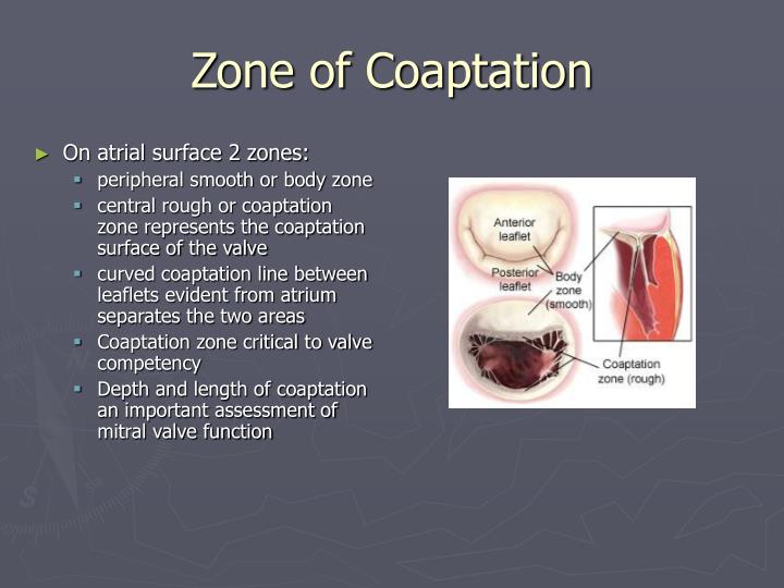 PPT - Assessing The Mitral Valve: in relation to mitral regurgitation ...