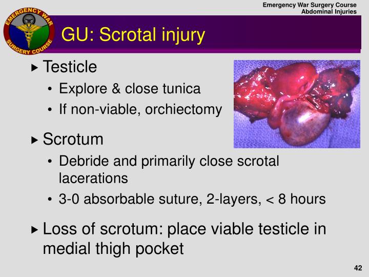 PPT - Abdominal Injuries PowerPoint Presentation - ID:976451