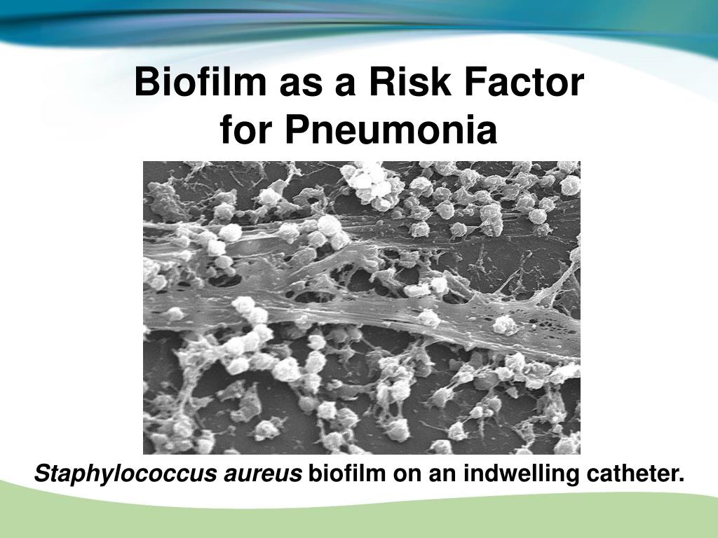 PPT - ASPIRATION PNEUMONITIS AND ASPIRATION PNEUMONIA Paul E. Marik, M ...