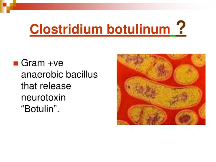 PPT - Botulism PowerPoint Presentation - ID:976650