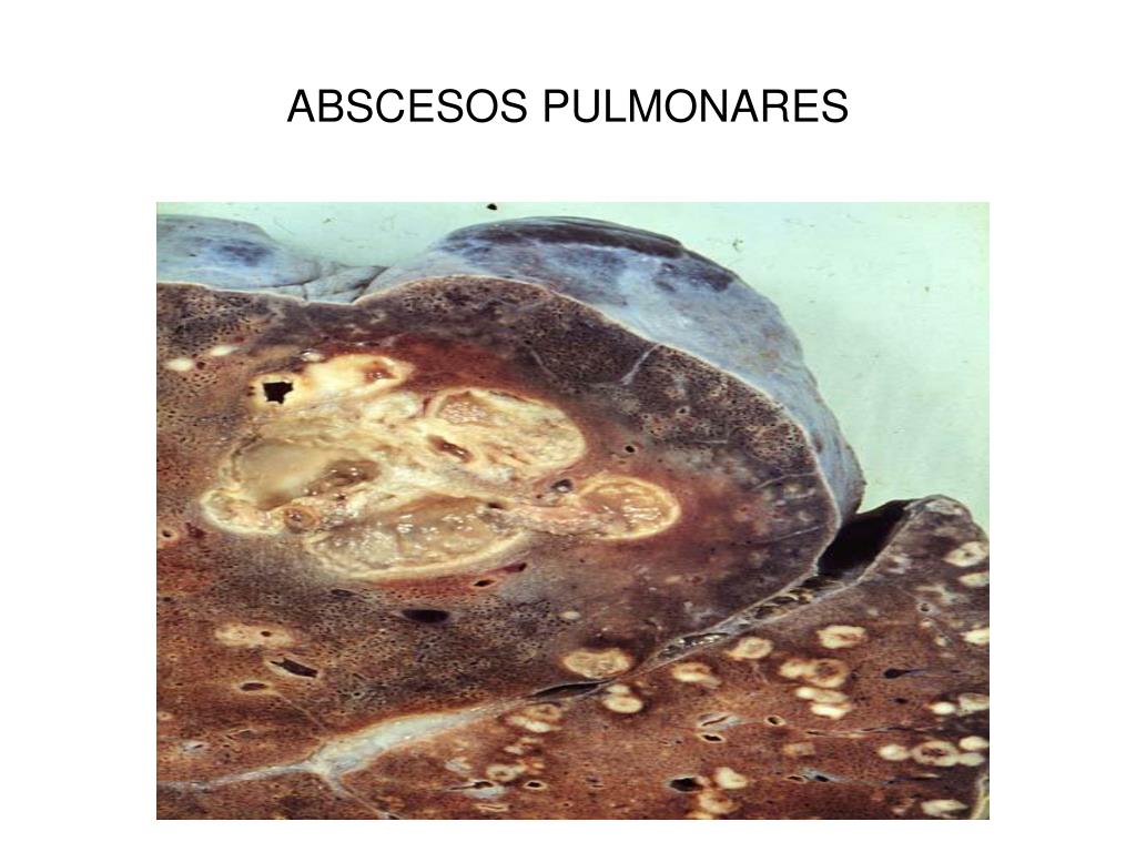 PPT - ANATOMÍA PATOLÓGICA GENERAL 3º CURSO. 2010 PowerPoint ...