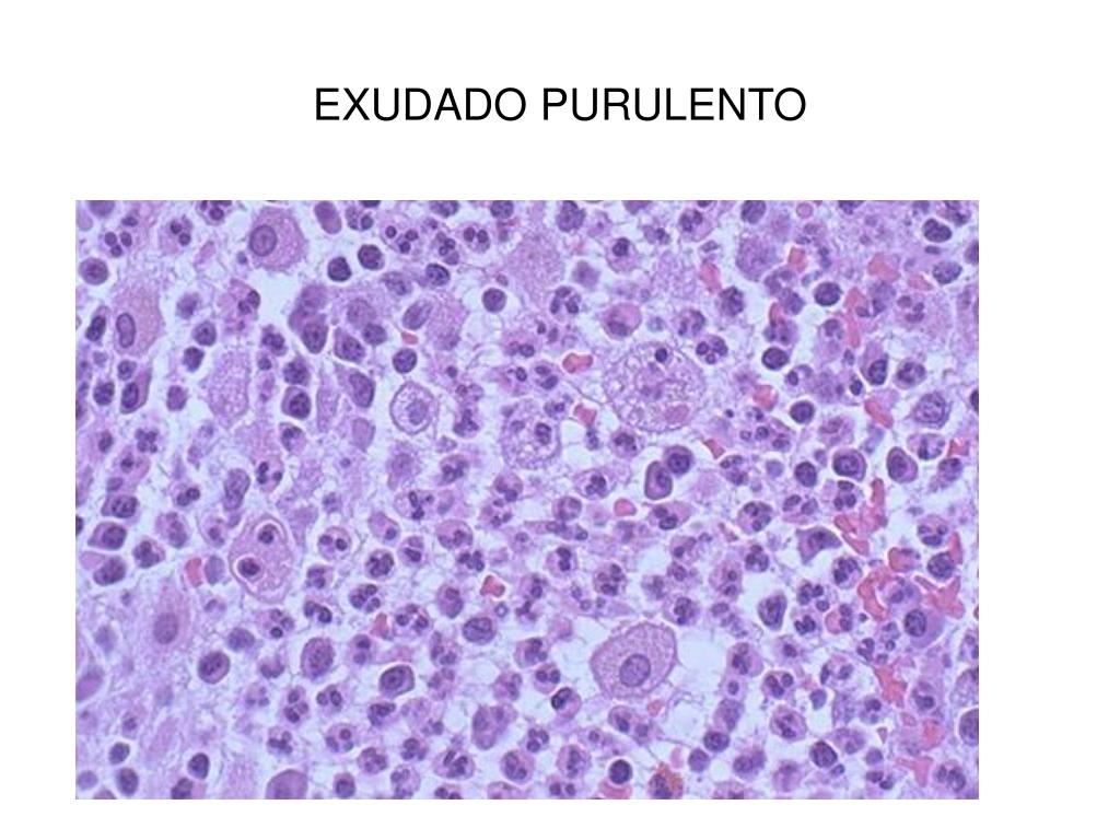 PPT - ANATOMÍA PATOLÓGICA GENERAL 3º CURSO. 2010 PowerPoint ...